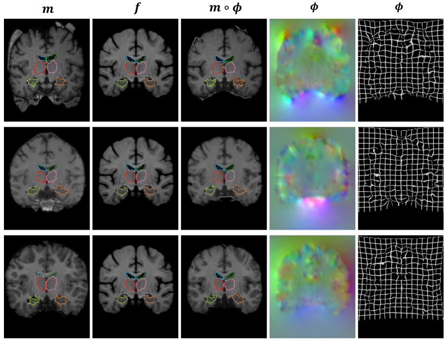 (2018)VoxelMorph: A Learning Framework for Deformable Medical Image Registration